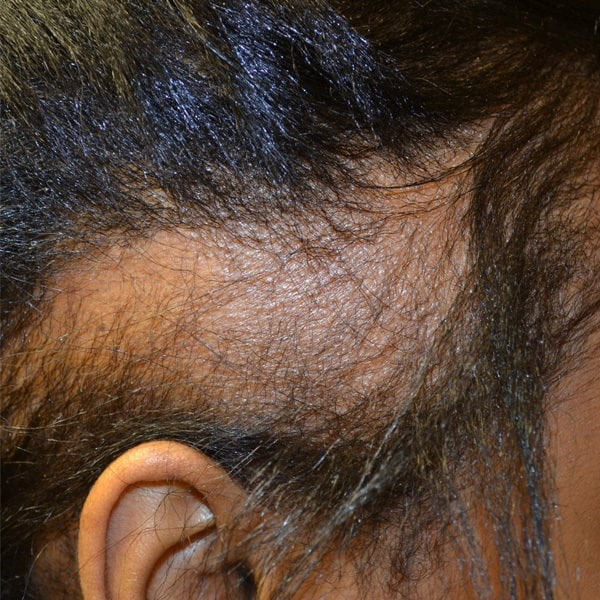 Follicle Activator 3.0 – Crown Naturale