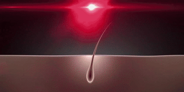 Follicle Activator 3.0 – Crown Naturale